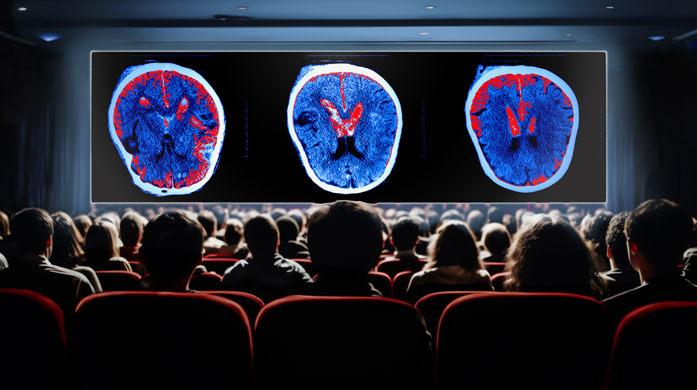 Spotlight: Brain mapping | MIT - Massachusetts Institute of Technology