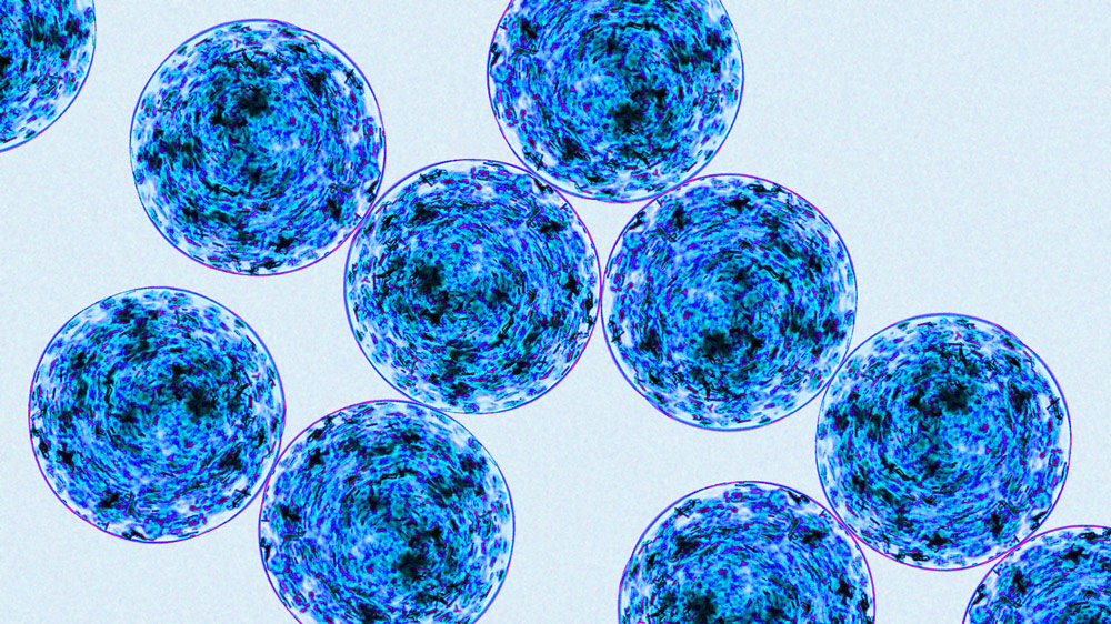 Spotlight: Protecting medical implants | MIT - Massachusetts Institute ...