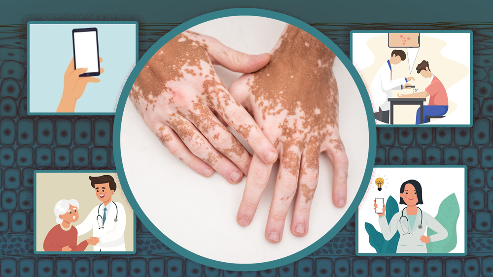 Spotlight: Faster skin diagnoses | MIT - Massachusetts Institute of ...