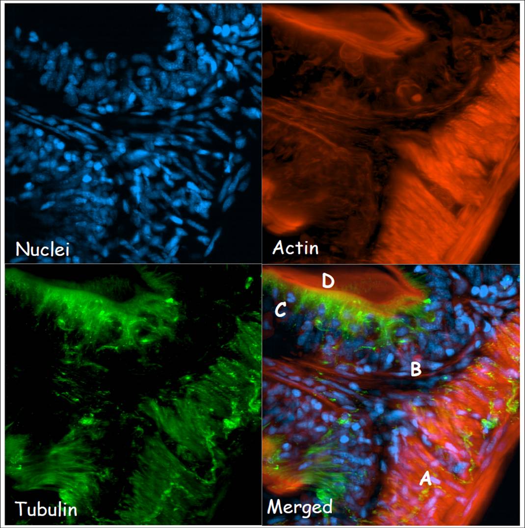 SMART: BioSystems and Micromechanics (BioSyM)